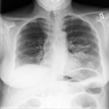 Gifsplanation - Explaining neural networks with gifs!